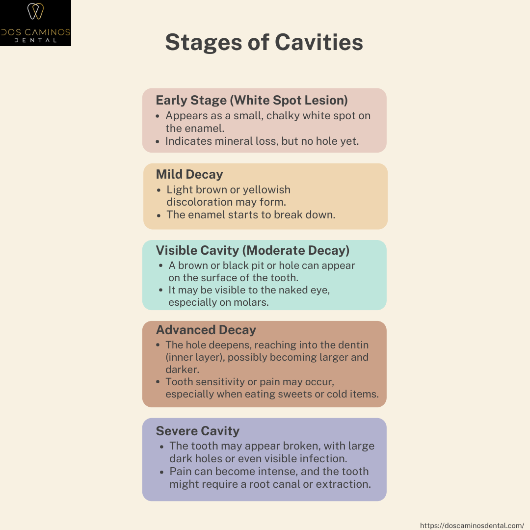 What Does a Cavity Look Like? Early Signs Explained